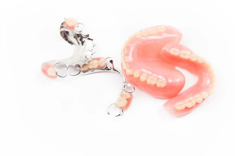 Bridges, Partials & Dentures - Washington Court House, OH | Ginn Dental ...